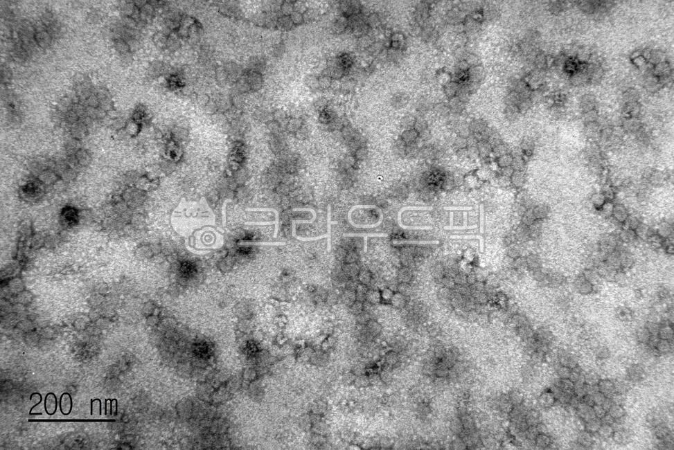 tem, microvesicle, nanovesicle, exosome, nanosome, 사진,이미지,일러스트,캘리그라피 ...